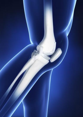 Understanding Bone Marrow Edema-Linked To Osteonecrosis – Joint Purpose